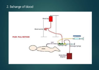 EXCHANGE TRANSFUSION AND UVC.pptx made by dr shahzaib | PPTX