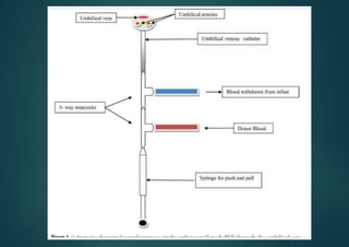 EXCHANGE TRANSFUSION AND UVC.pptx made by dr shahzaib | PPTX