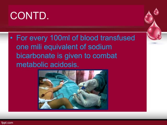 Exchange Transfusion PPT | PPT | Pregnancy | Reproductive Health