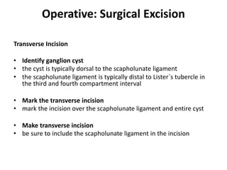 Excision of a ganglion | PPTX