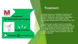 Excision of Branchial cyst surgery.pptx | Ear, Nose and Throat ...