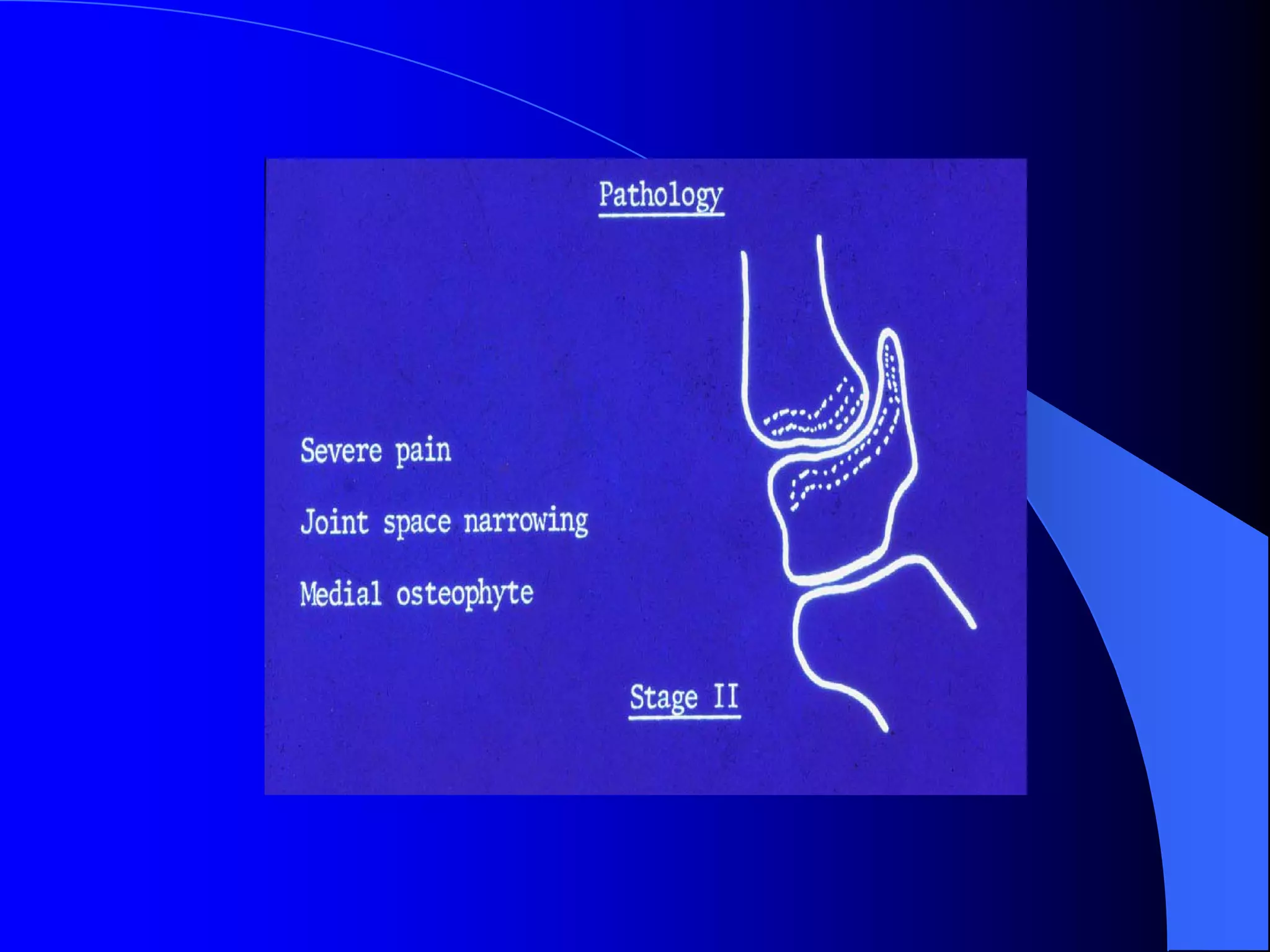 Excision of the trapezium presentation | PDF