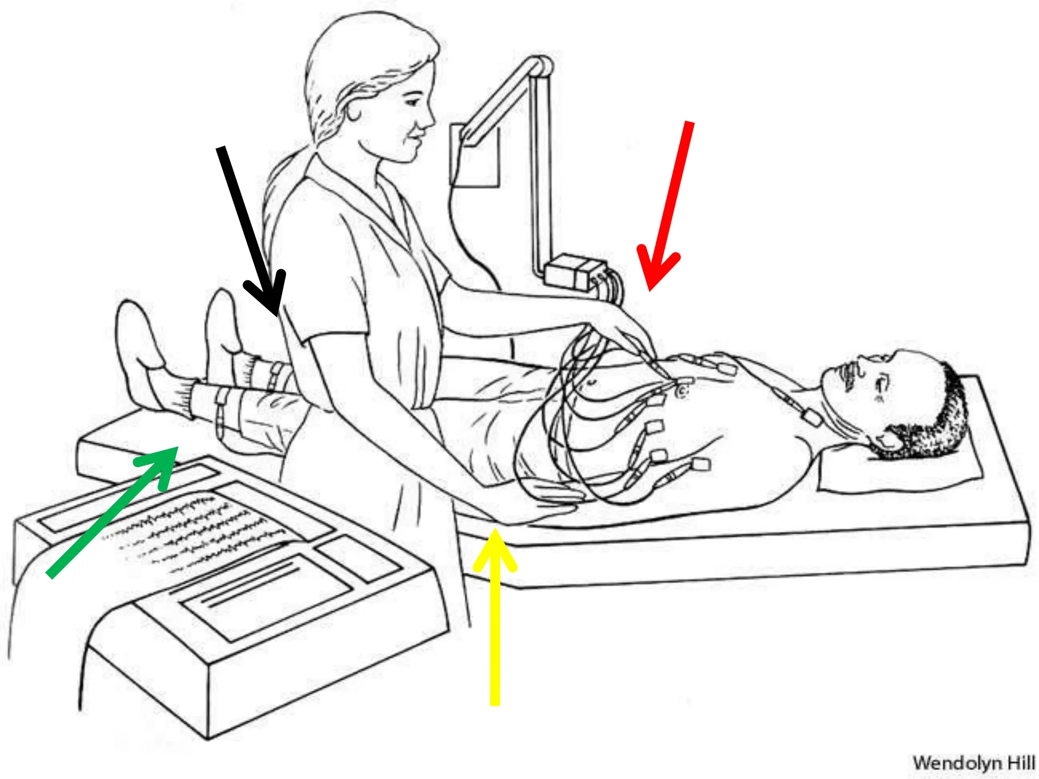 Excitations of heart rhythms and ECG.ppt | Heart and Cardiovascular ...
