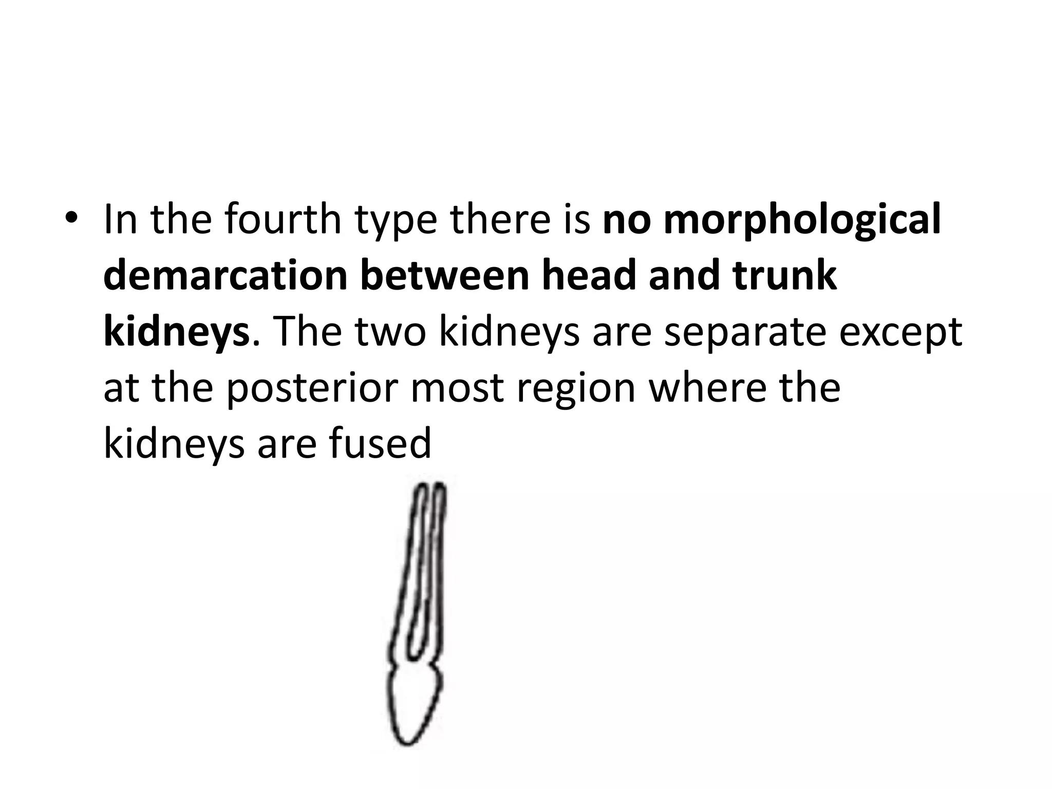 Excretory system of fishes | PPTX