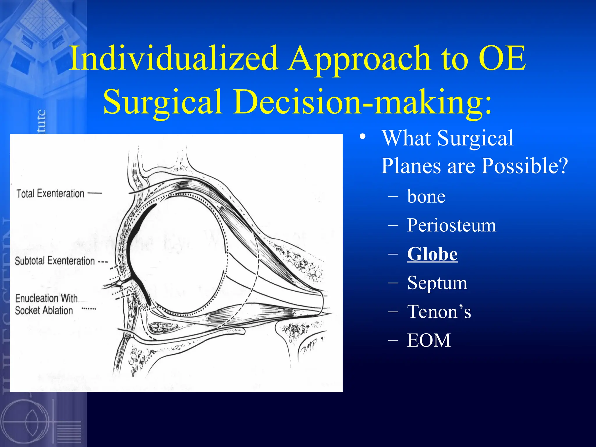 Exenteration of the Orbit - orbital surgery | PPT