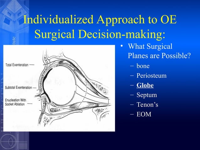 Exenteration of the Orbit - orbital surgery | PPT