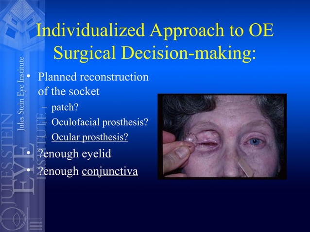Exenteration of the Orbit - orbital surgery | PPT