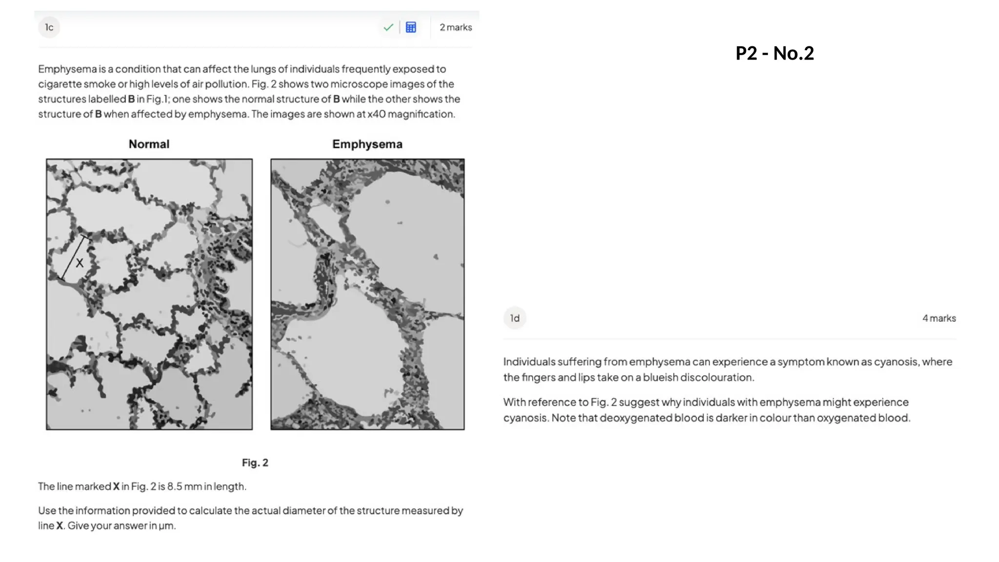 Exercise - Gas Exchange in Human Respiratory System | PPTX