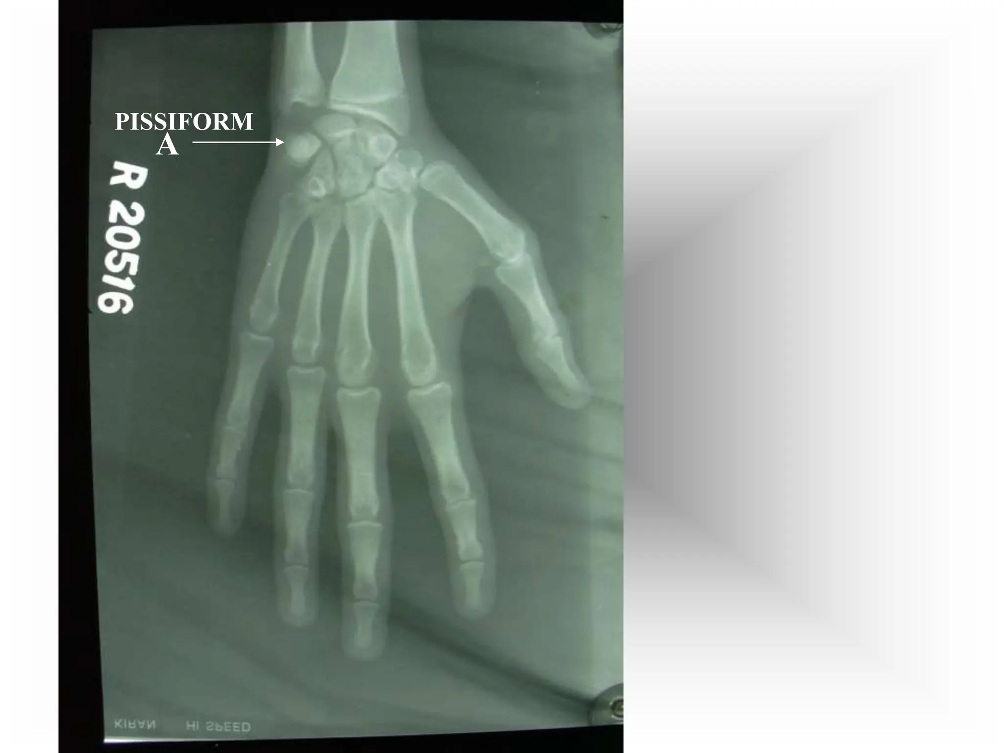 pratical Forensic medicine Exercise-X-Rays.ppt
