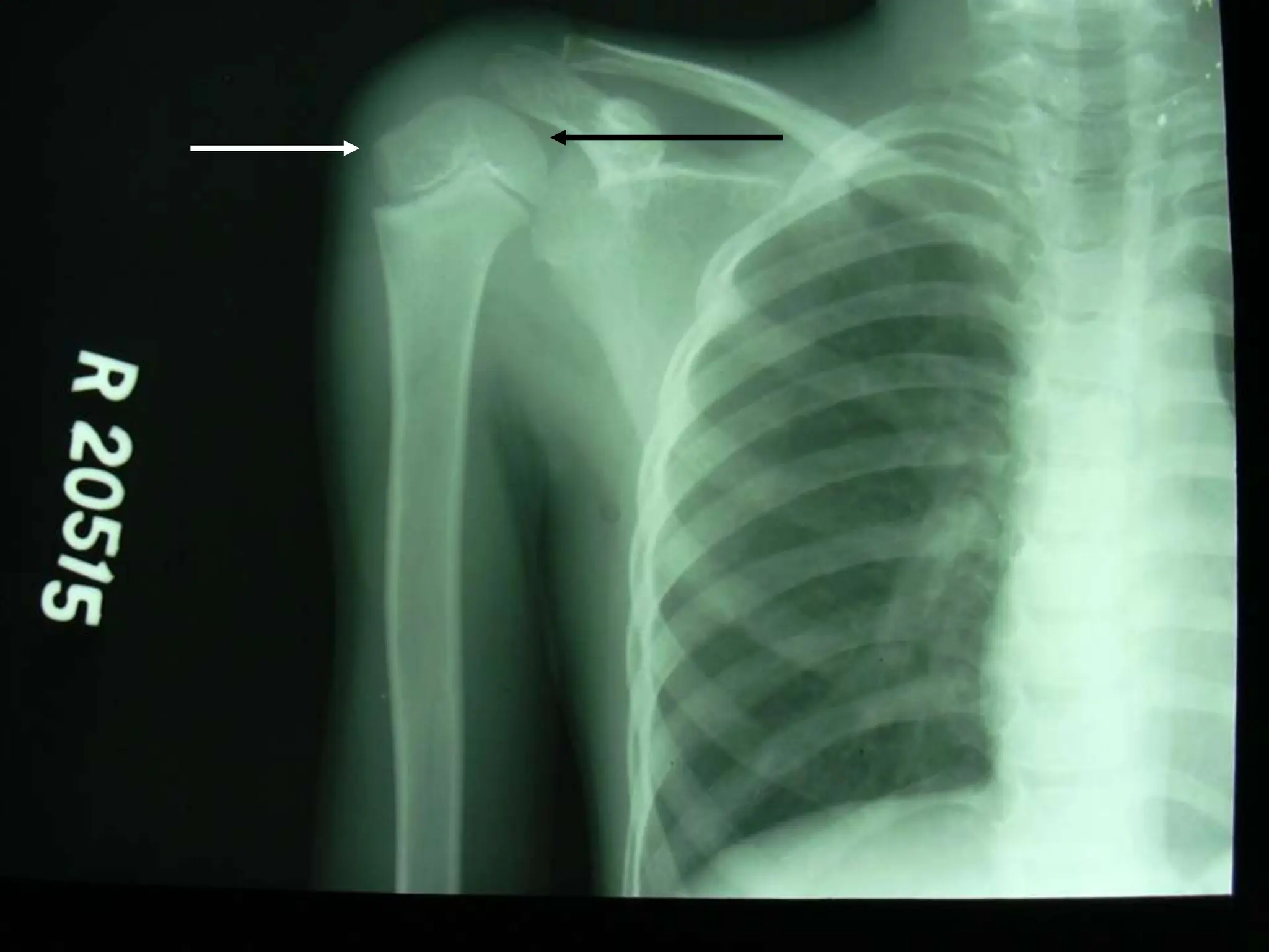 pratical Forensic medicine Exercise-X-Rays.ppt