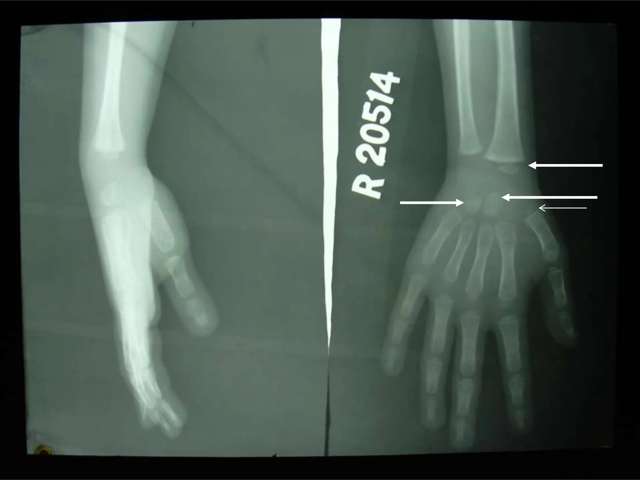 pratical Forensic medicine Exercise-X-Rays.ppt