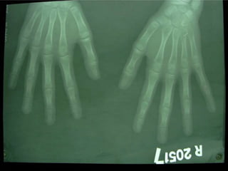 pratical Forensic medicine Exercise-X-Rays.ppt