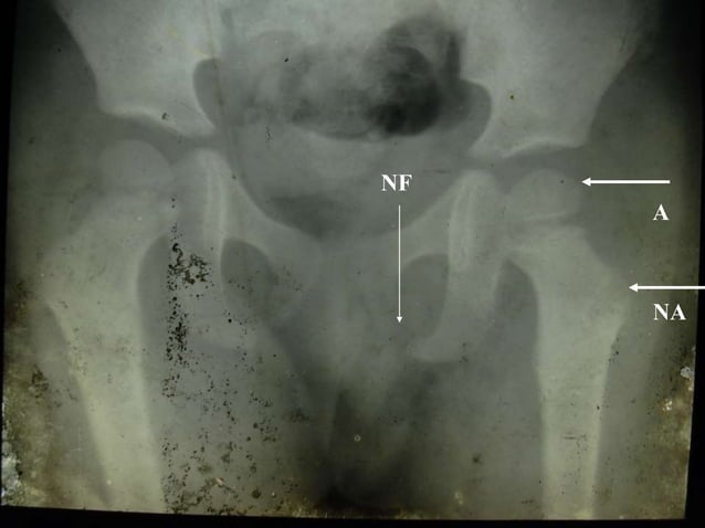 pratical Forensic medicine Exercise-X-Rays.ppt