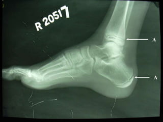 pratical Forensic medicine Exercise-X-Rays.ppt