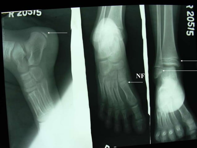 pratical Forensic medicine Exercise-X-Rays.ppt