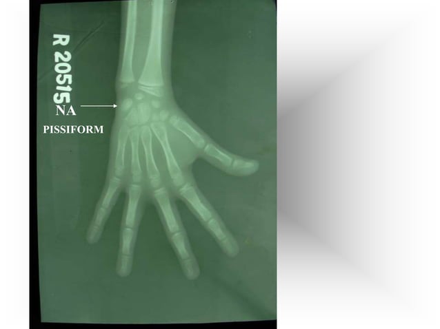 pratical Forensic medicine Exercise-X-Rays.ppt