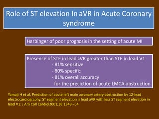 EXERCISE INDUCED ST ELEVATION _ DR SAJEER KT.ppsx