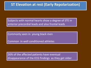 EXERCISE INDUCED ST ELEVATION _ DR SAJEER KT.ppsx