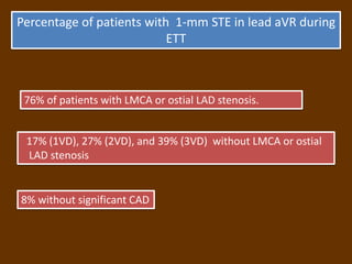 EXERCISE INDUCED ST ELEVATION _ | PPSX