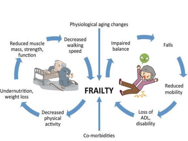 Exercise issues and aging