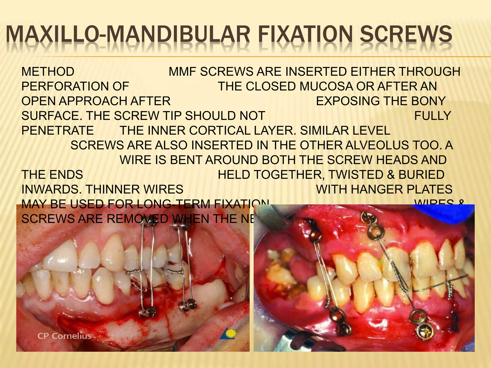 Exercise Modules | PPTX