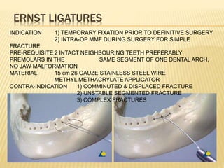 Exercise Modules | PPTX