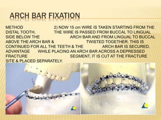 Exercise Modules | PPTX