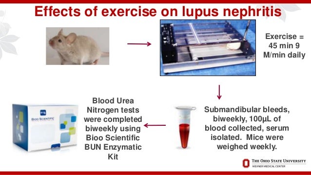 "Stress is Detrimental and Moderate Exercise is Beneficial to Lupus N…