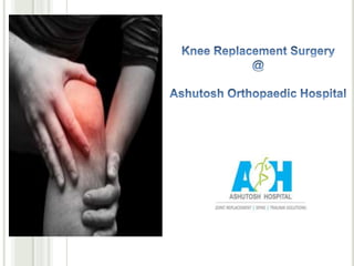 Exercises that help decrease knee pain | PPTX