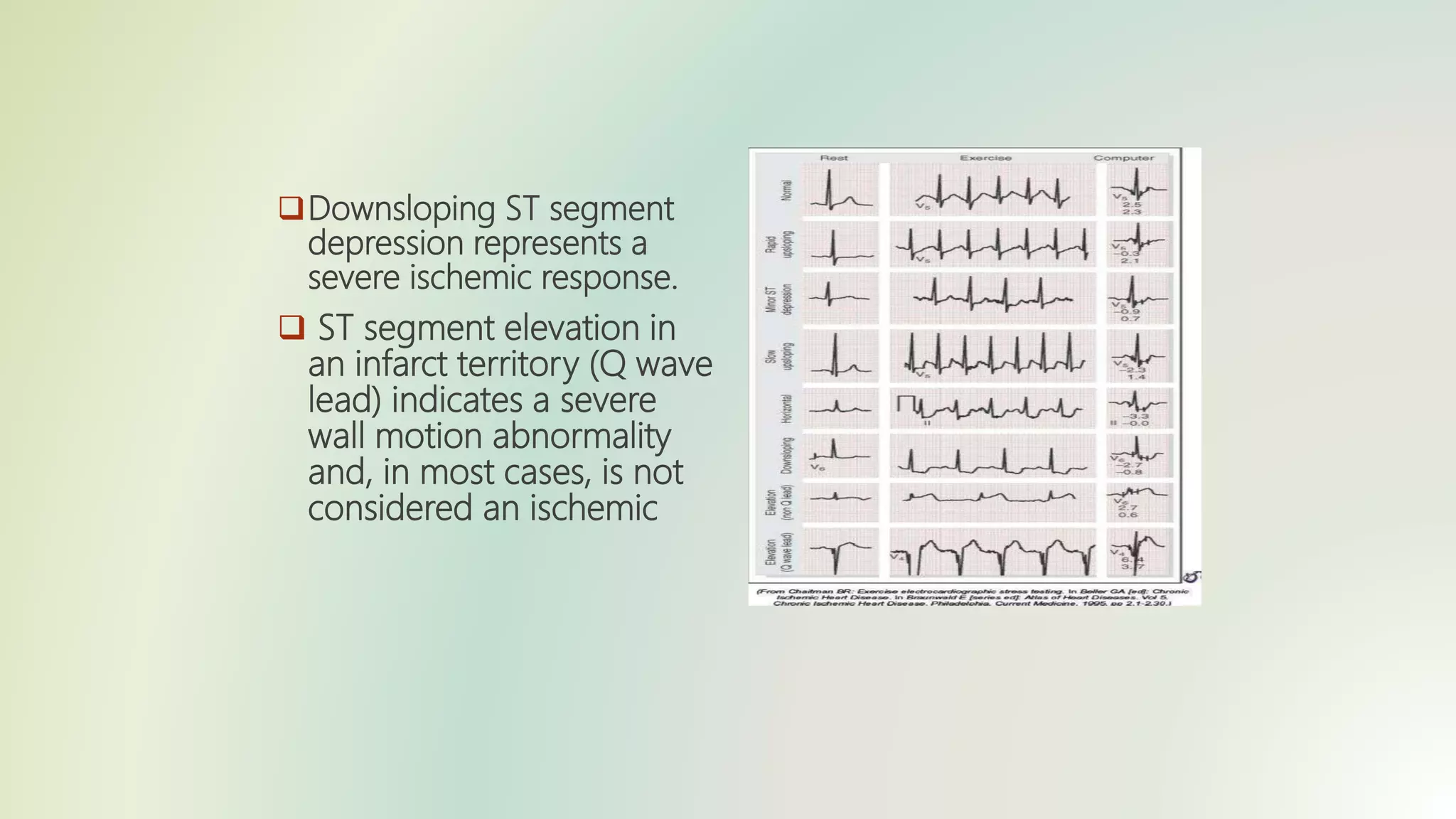Exercise stress testing | PPTX