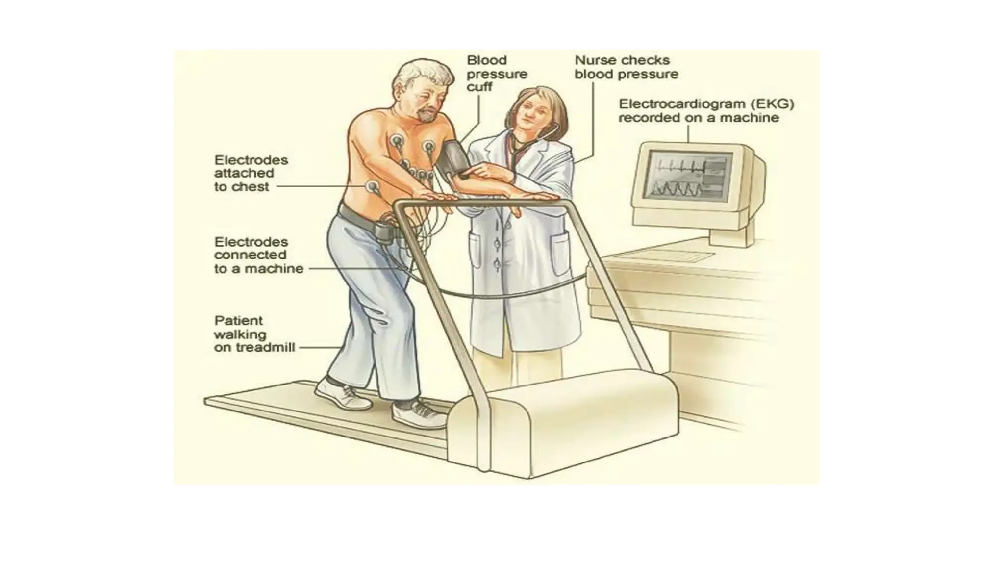 Exercise Stress Test Tredmill test by mohsin.pptx