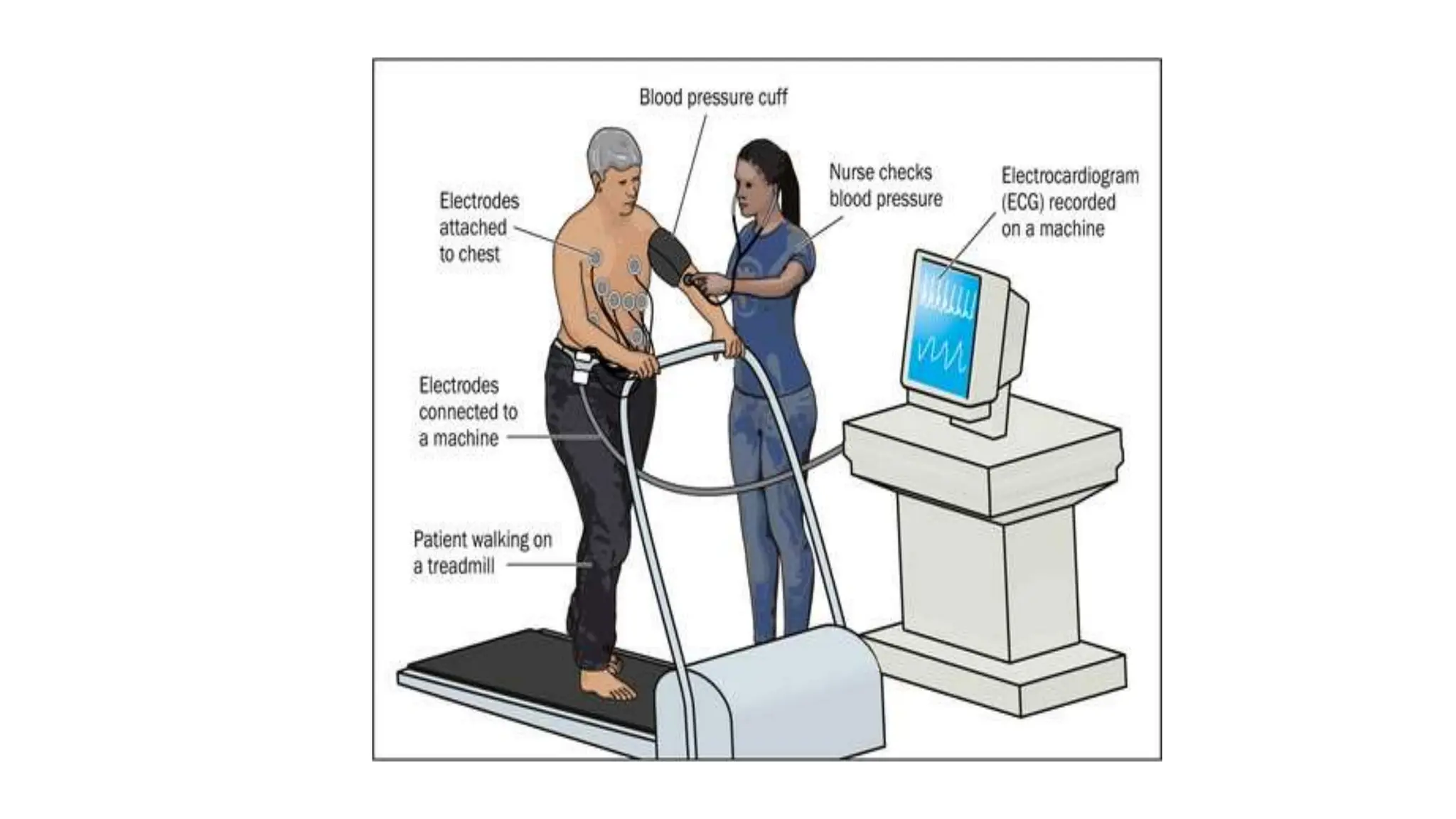 EXERCISE TOLERENCE TEST | PPTX