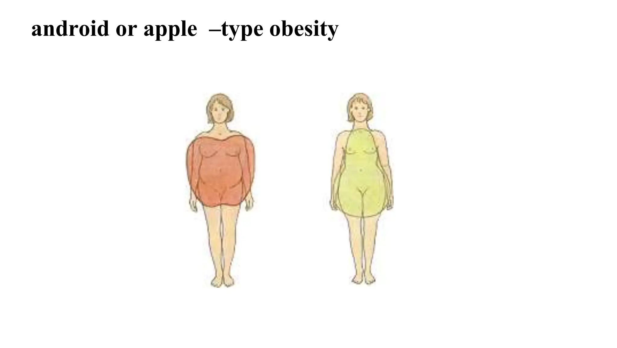 Exercise training for obesity.pptx. Complete | PPT