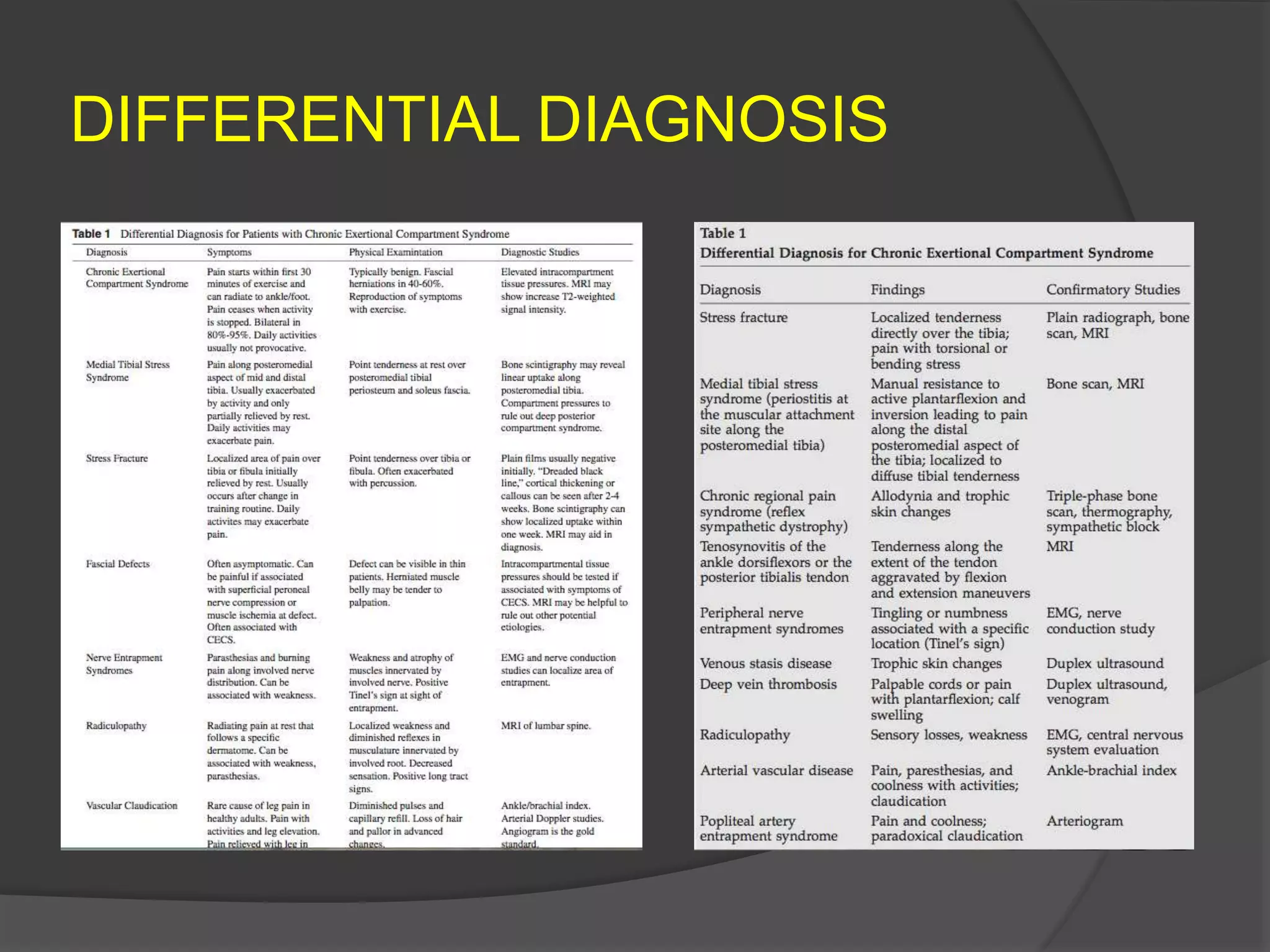 Chronic Exertional Compartment Syndrome (University of Florida) | PPTX