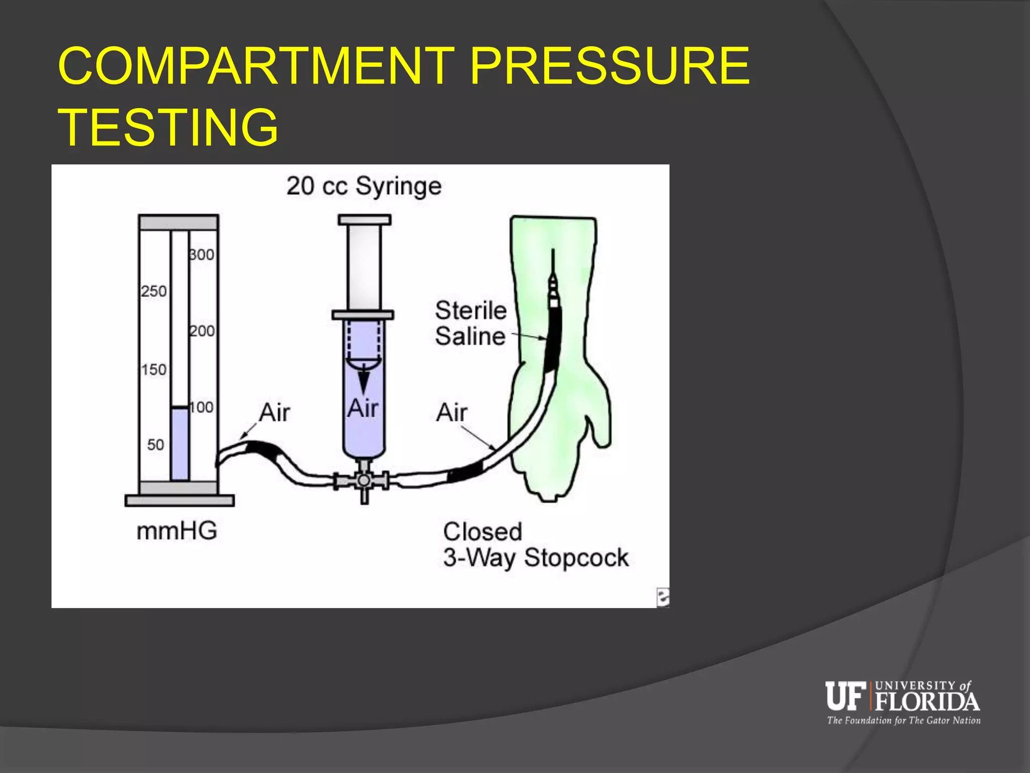 Chronic Exertional Compartment Syndrome (University of Florida) | PPTX ...