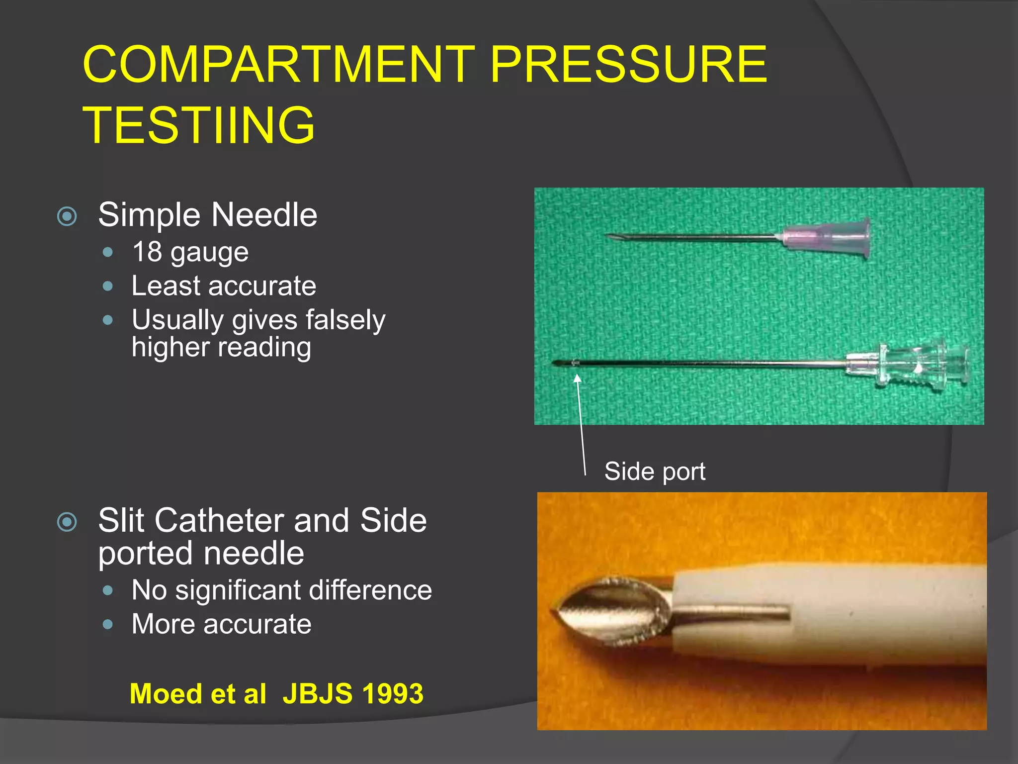 Chronic Exertional Compartment Syndrome (University of Florida) | PPTX