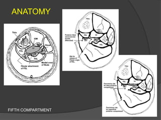 Chronic Exertional Compartment Syndrome (University of Florida) | PPTX