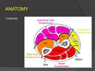 Chronic Exertional Compartment Syndrome (University of Florida) | PPTX