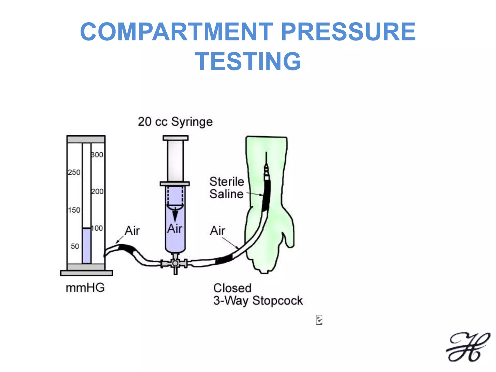 Chronic Exertional Compartment Syndrome (Henry Ford Health System) | PPTX | Death, Injury, or ...