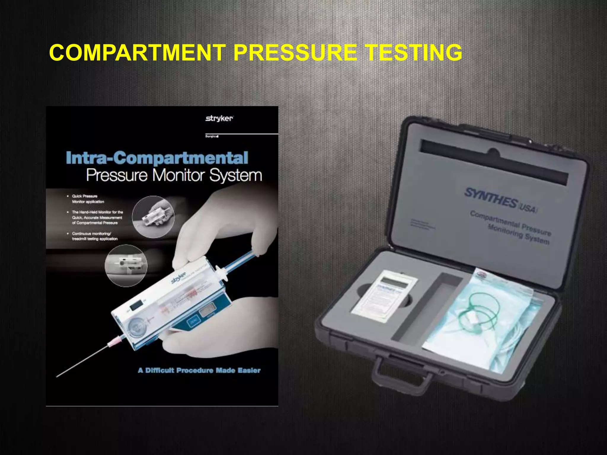 Chronic Exertional Compartment Syndrome (Henry Ford Health System) | PPTX | Death, Injury, or ...