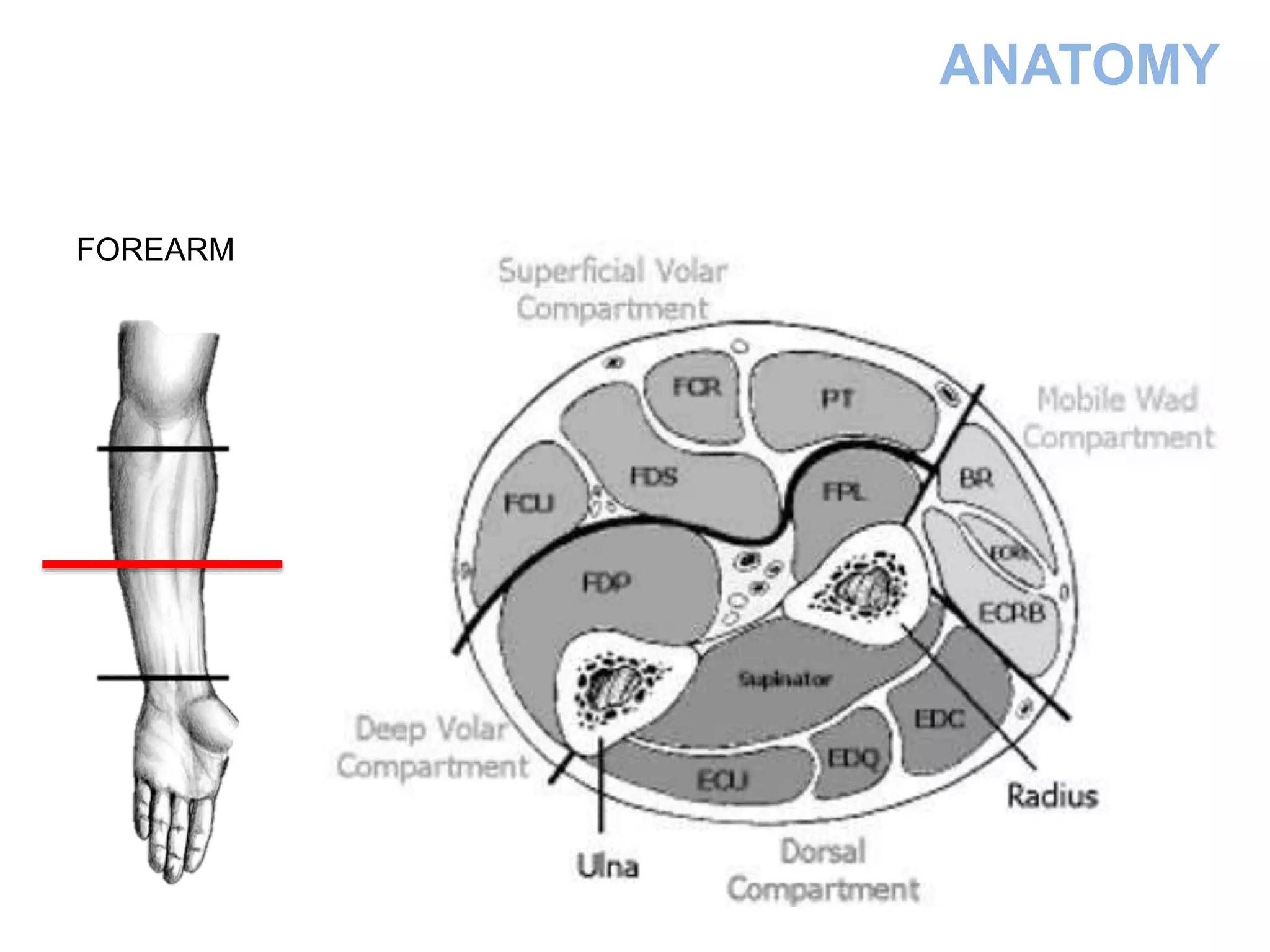 Chronic Exertional Compartment Syndrome (Henry Ford Health System) | PPTX | Death, Injury, or ...