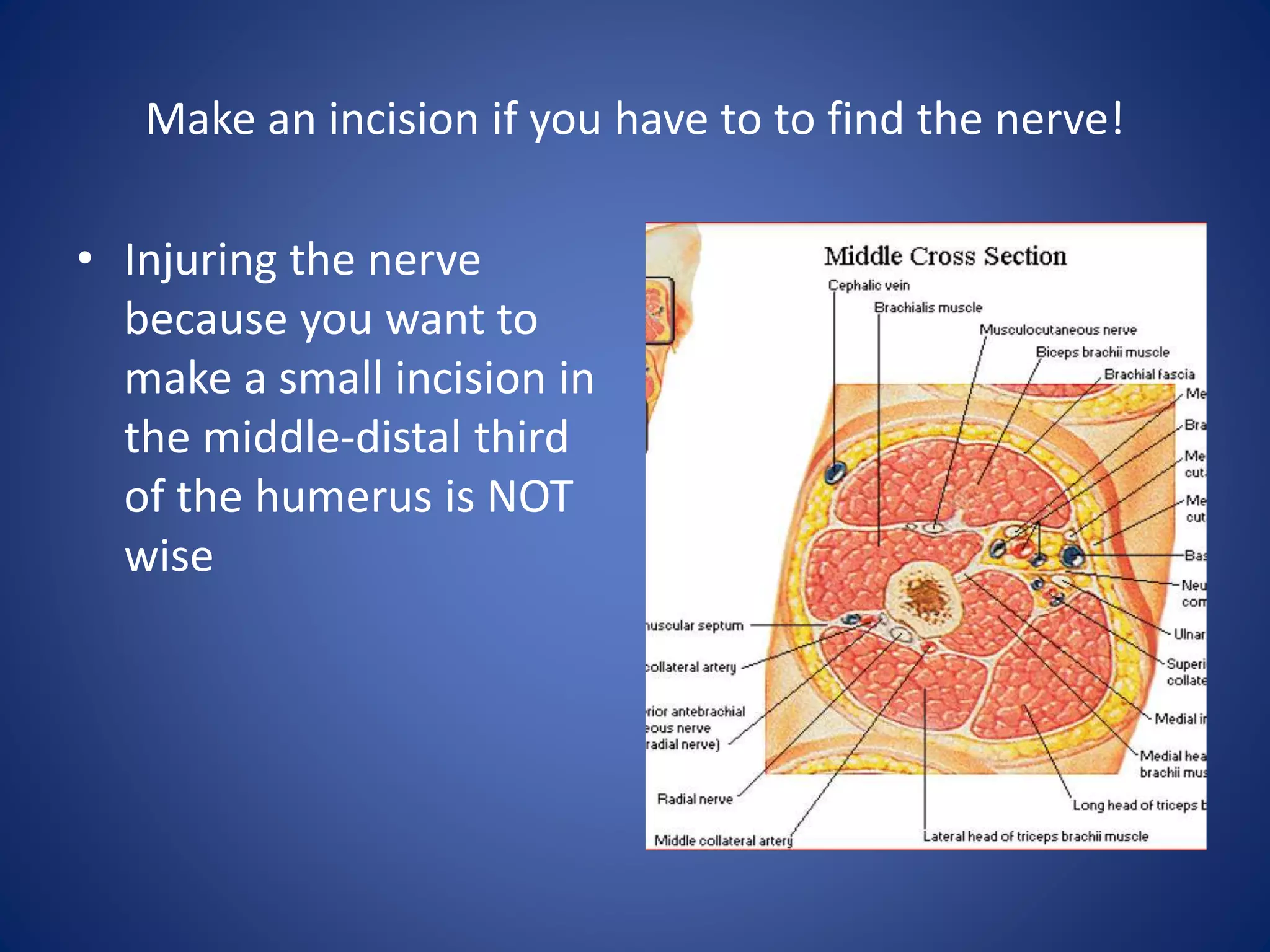 Humerus External Fixation, Avoiding Neuro vascular injury | PPT