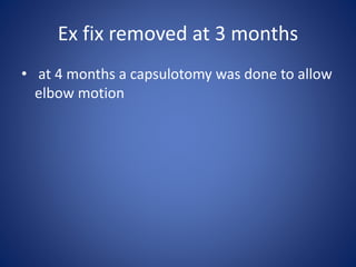 Humerus External Fixation, Avoiding Neuro vascular injury | PPTX