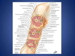 Humerus External Fixation, Avoiding Neuro vascular injury | PPTX