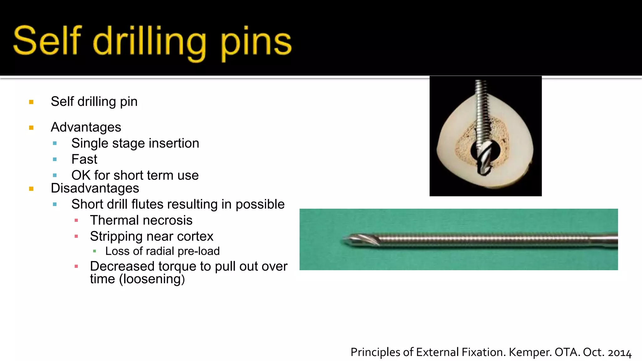 external fixation re | PPTX