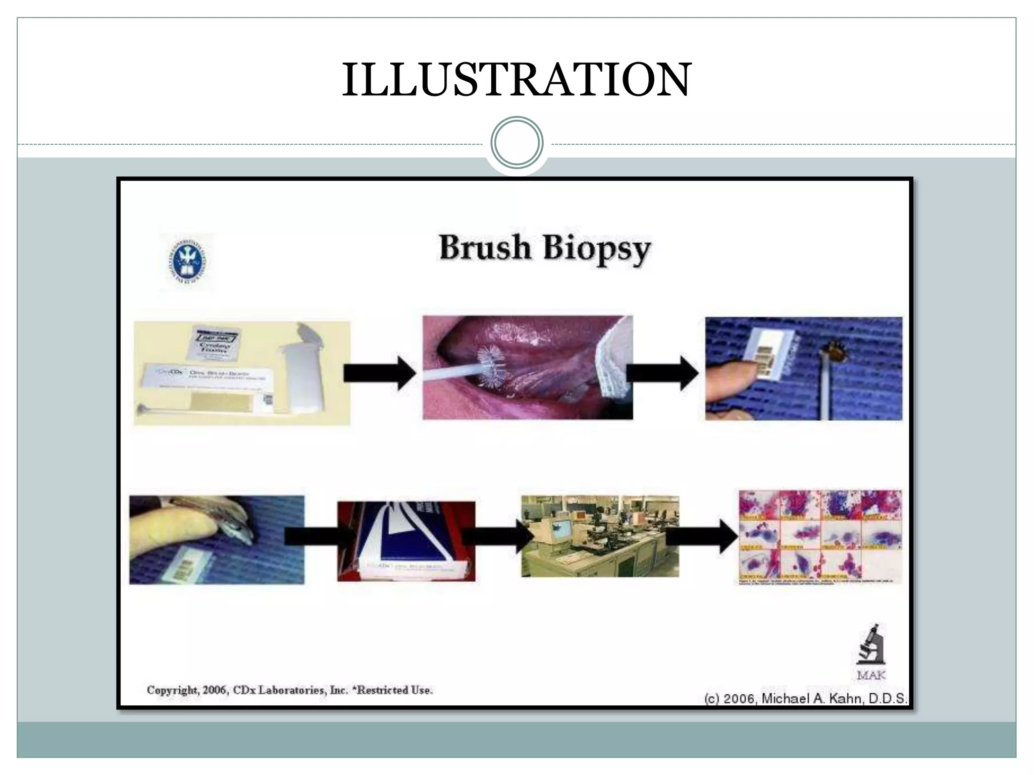 Exfoliative cytology | PPTX