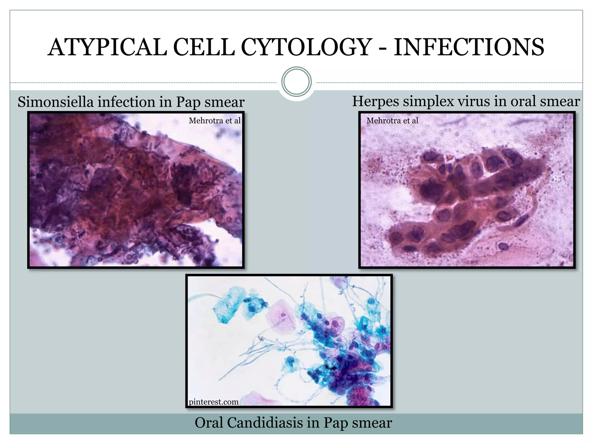 Exfoliative cytology | PPTX