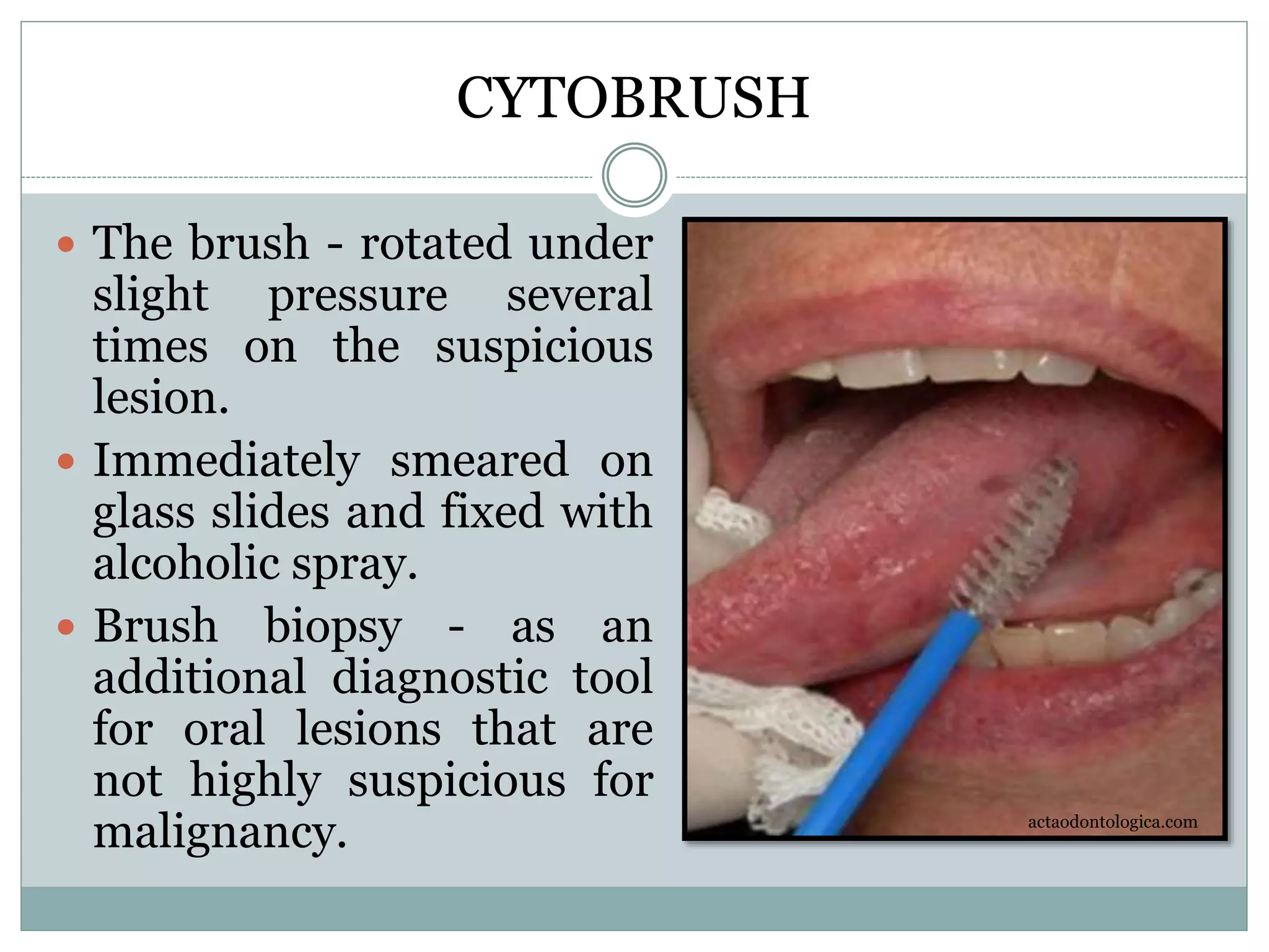 Exfoliative cytology | PPTX