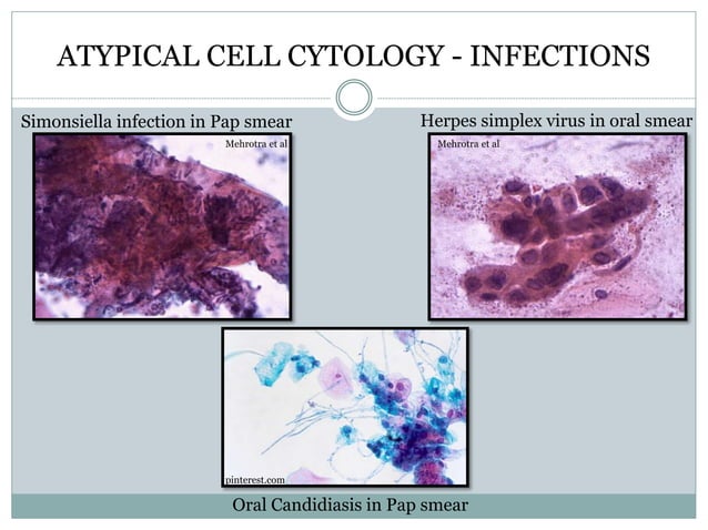 Exfoliative cytology