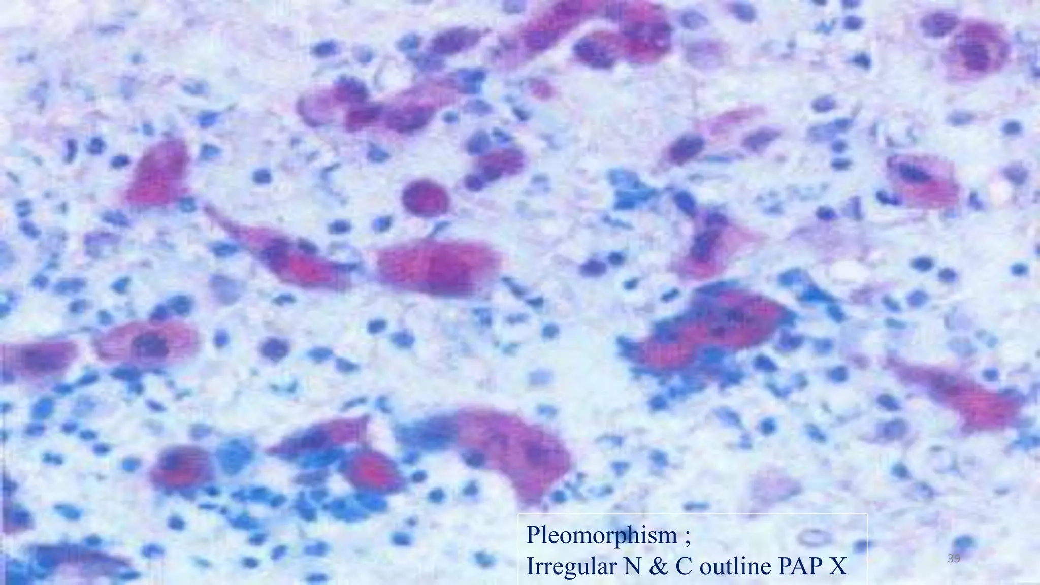 Exfoliative cytology | PPTX
